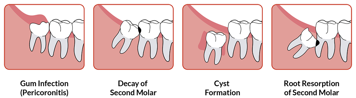 - Khoo Teck Puat Hospital
